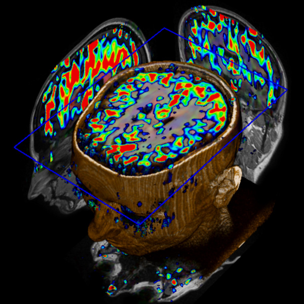 Chinese Gen MRI Center - Services