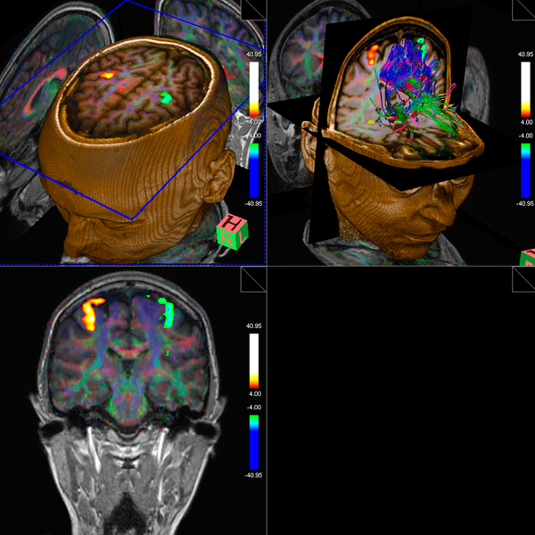 Chinese Gen MRI Center - Services