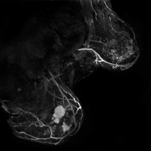 Chinese Gen MRI Center - Services