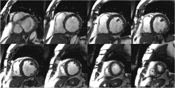 Chinese Gen MRI Center - Services