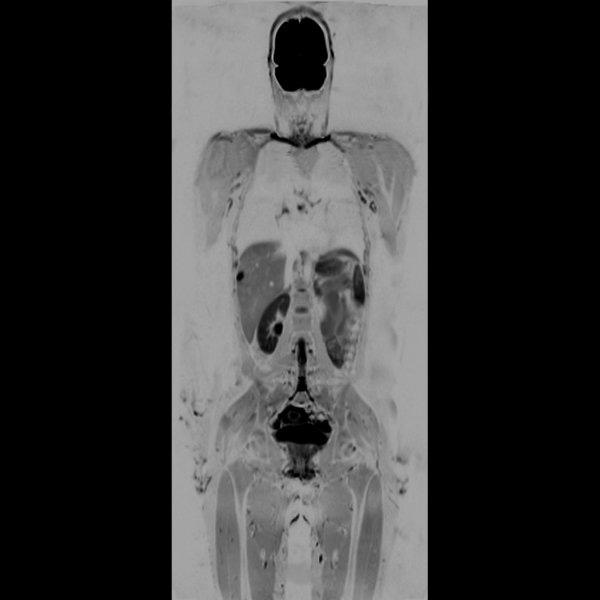 Chinese Gen MRI Center - Services