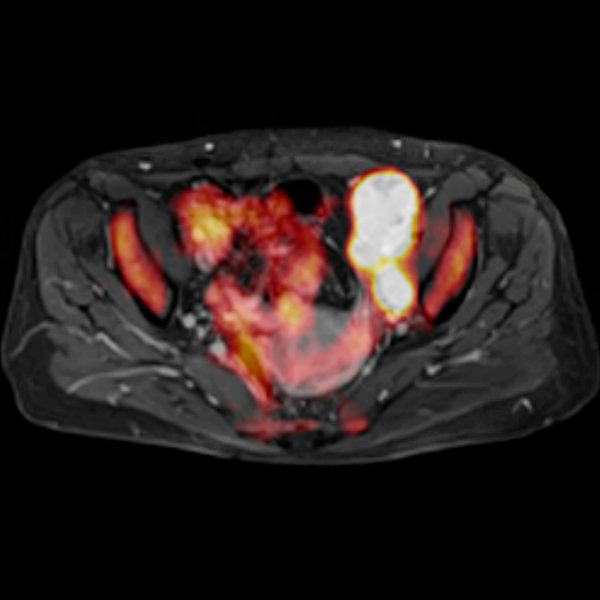 Chinese Gen MRI Center - Services