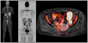 Chinese Gen MRI Center - Services